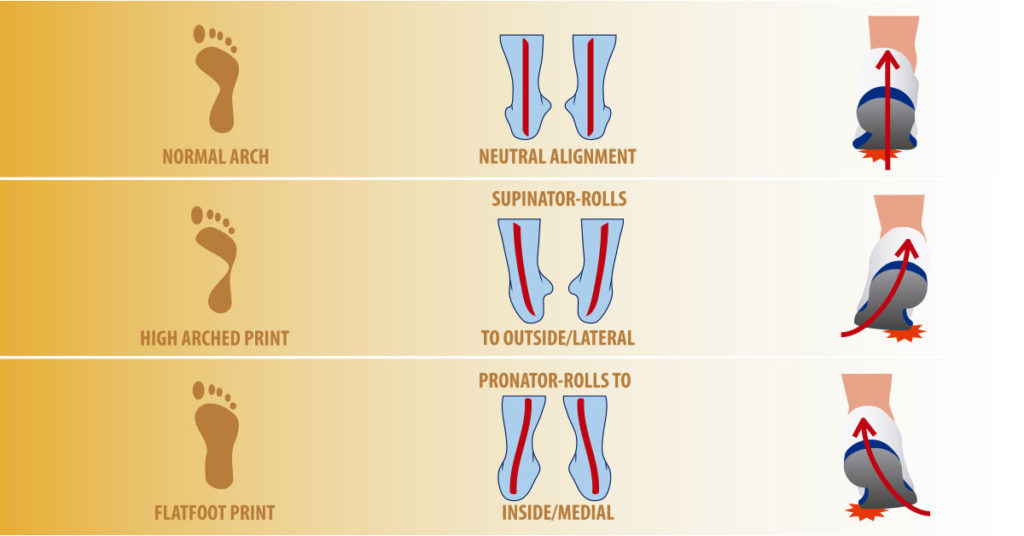 ¿Cómo elegir los mejores tenis para correr según tu tipo de pisada ...